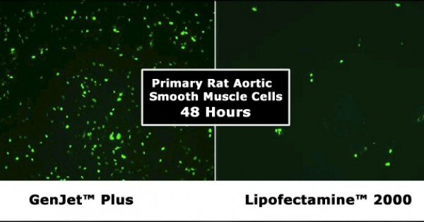 GenJet™ Plus DNA In Vitro Transfection Reagent (1.0 ml)